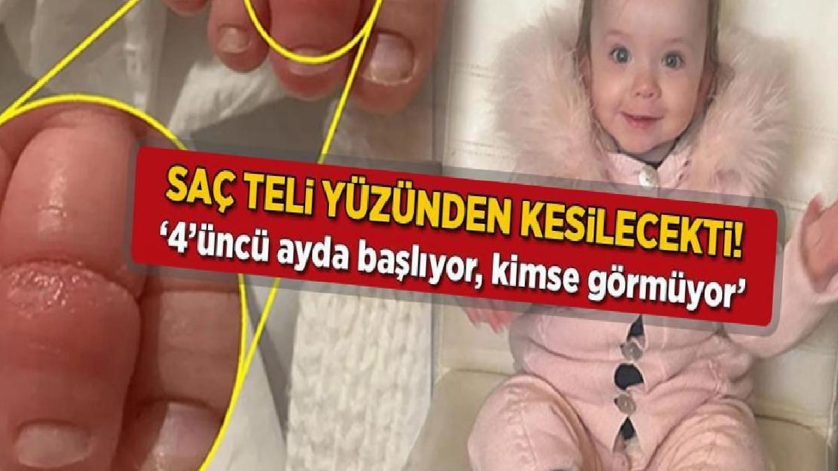 Saç teli yüzünden parmağı kesilecekti! '4'üncü ayda artıyor, kimse ...
